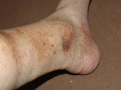 Medical Massage Courses & Certification | Science of Massage Institute ...