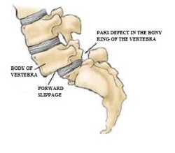 Medical Massage Courses & Certification | Science of Massage Institute ...