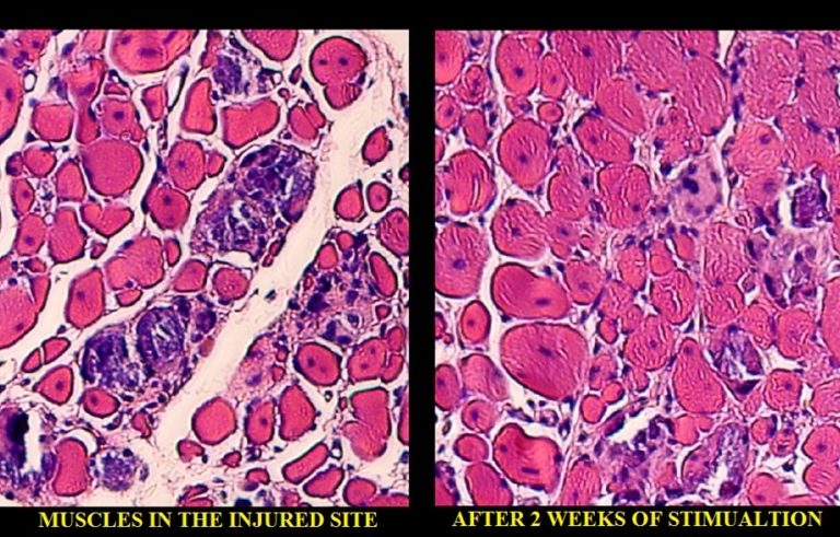 Medical Massage Courses & Certification | Science of Massage Institute ...