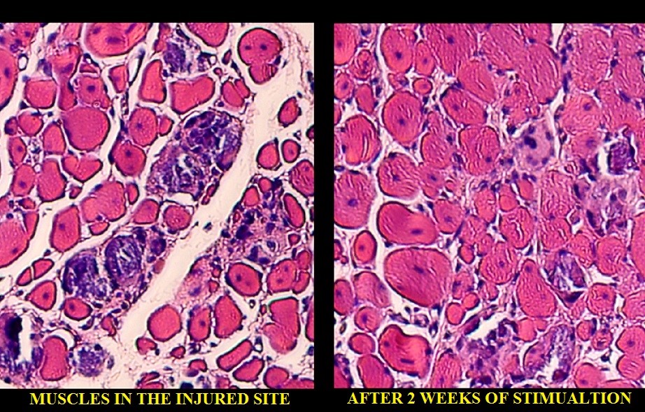 Medical Massage Courses & Certification | Science of Massage Institute ...